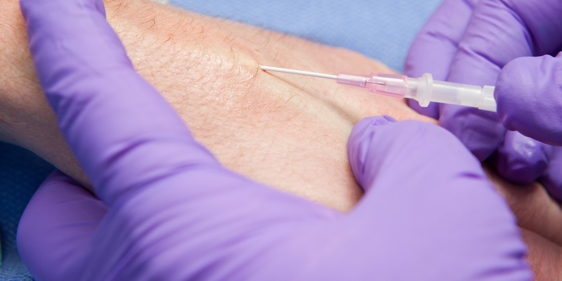 Contribution de l'infirmière auxiliaire à la thérapie intraveineuse ...